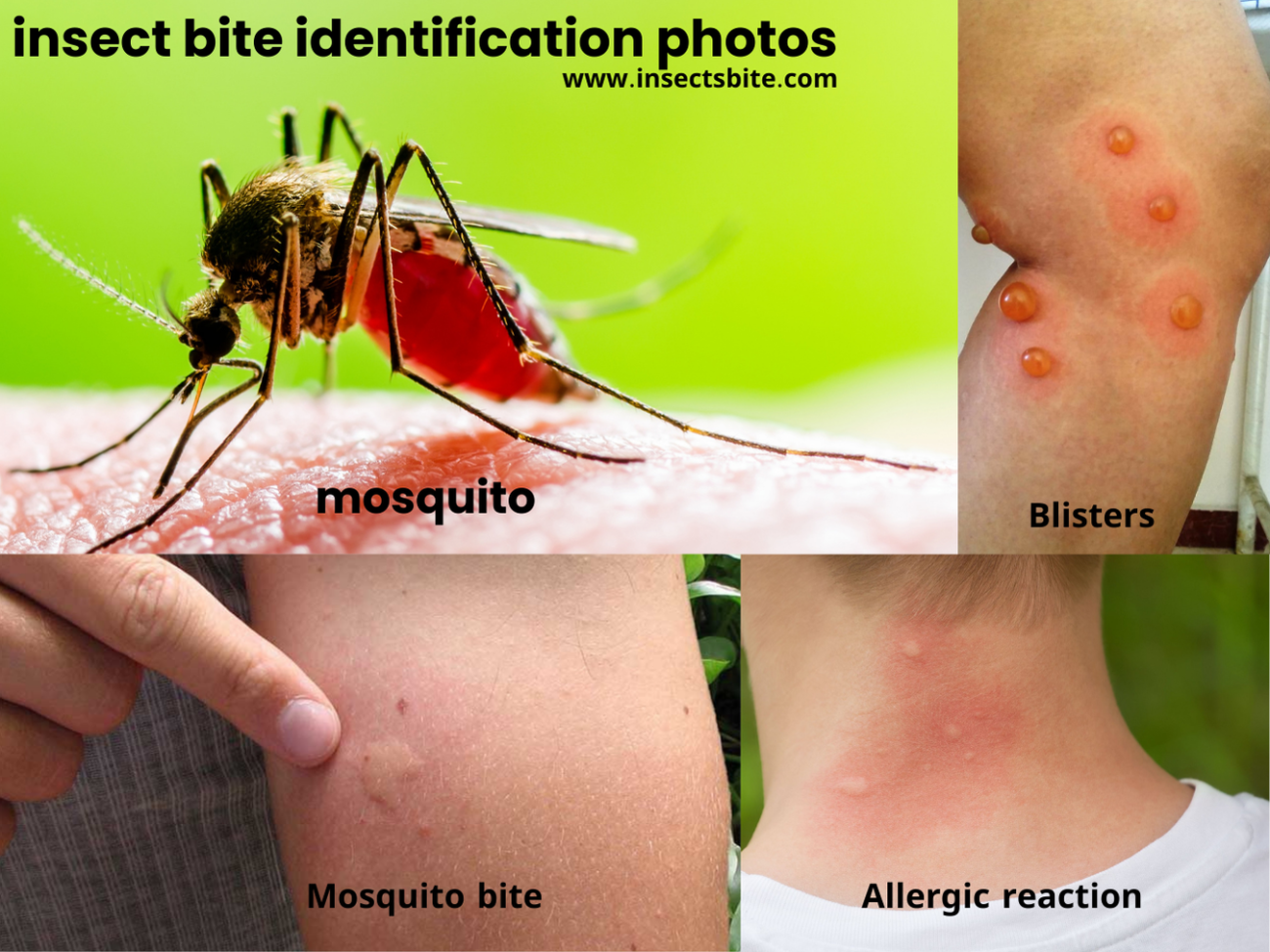 Insect Bite Identification Photos: Ultimate Guide to Spot Fast